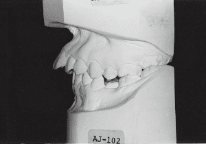 CASE101 - Yogosawa Foundation